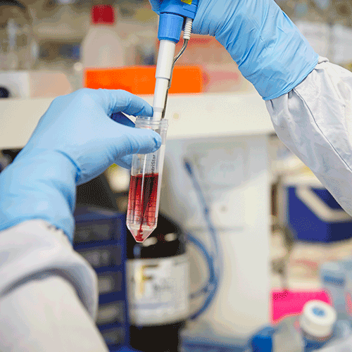 An exciting new test for childhood cancer – ‘liquid biopsy’ | Children ...